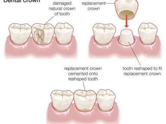 Anesthesia Dentistry General Children' For