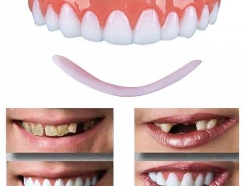 Teeth Veneer Covers
