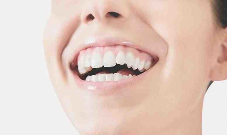 Cosmetic dentistry elongated front teeth - Dental News Network