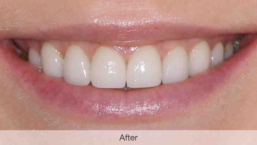 Cosmetic dentistry examples - Dental News Network
