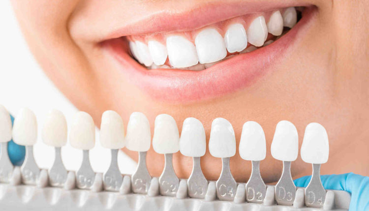 How to floss dental implants - Dental News Network