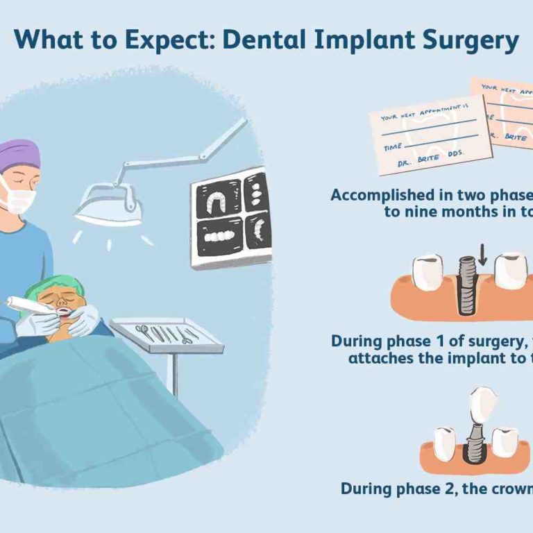 What is the procedure for dental implants - Dental News Network