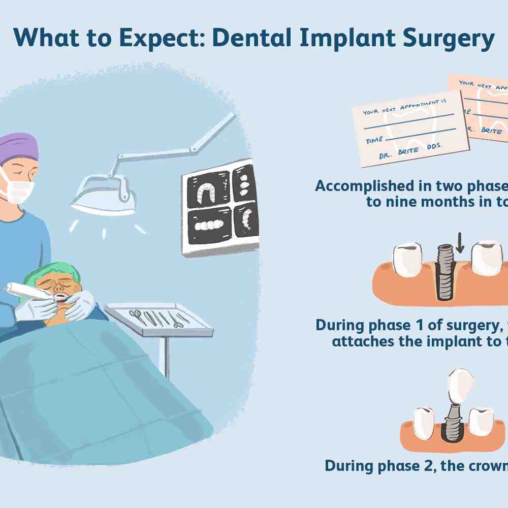 What is the procedure for dental implants - Dental News Network