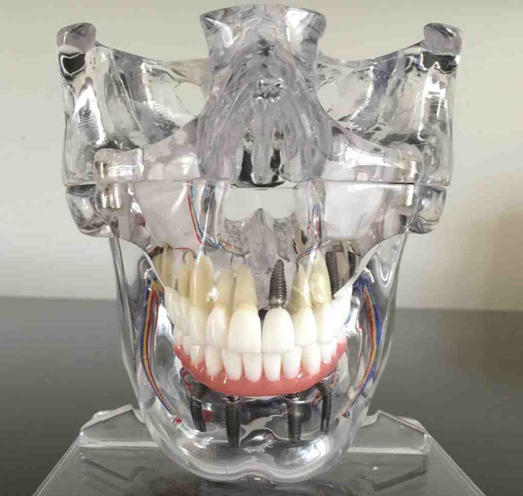 What Specialty Does Dental Implants Dental News Network What Specialty Does Dental Implants Dental News Network