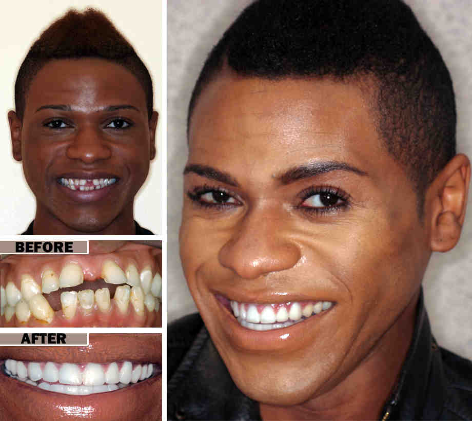 Cosmetic dentistry to restore smile - Dental News Network