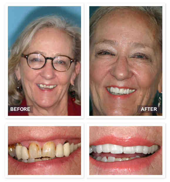 Cosmetic dentistry scottsdale, az dentist - Dental News Network