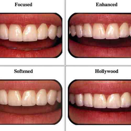 Cosmetic dentistry size shape color - Dental News Network