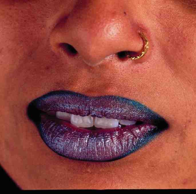 Cosmetic dentistry relaxed lip line - Dental News Network