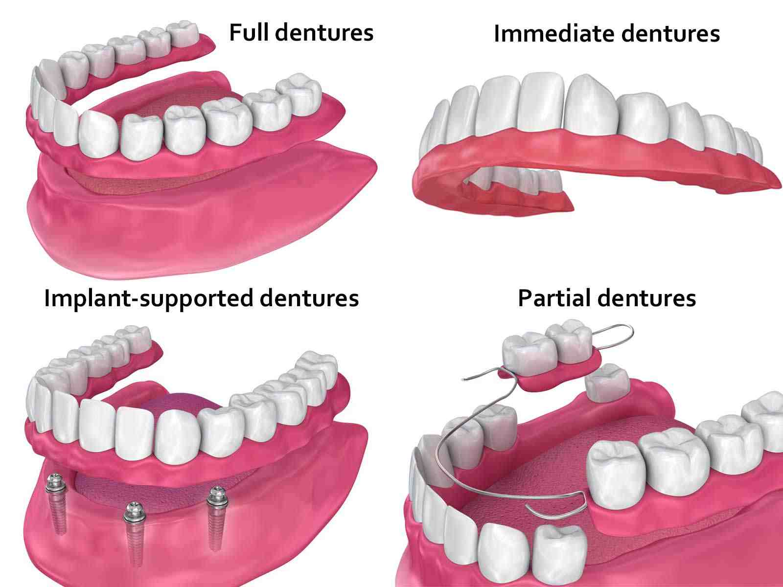 Is dental denches better than implants - Dental News Network