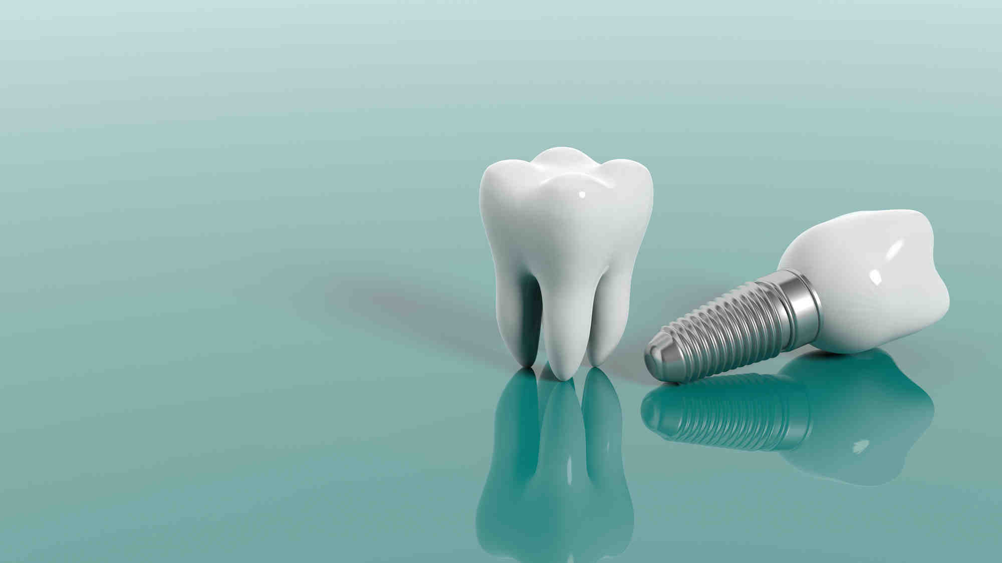 Should I Be Worried About Getting Dental Implants Dental News Network