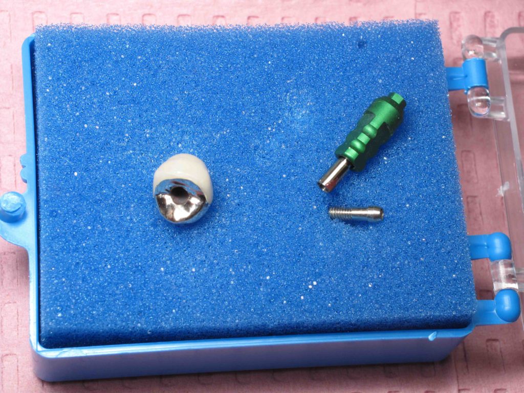 What kind of screws in dental implants - Dental News Network