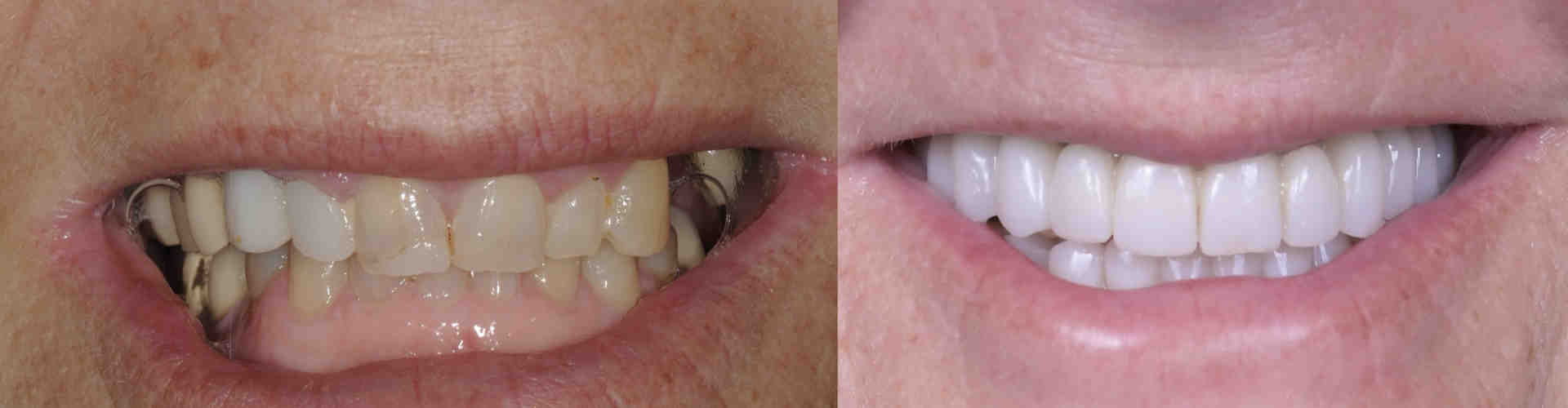 Surgical Cosmetic Dentistry Dental News Network