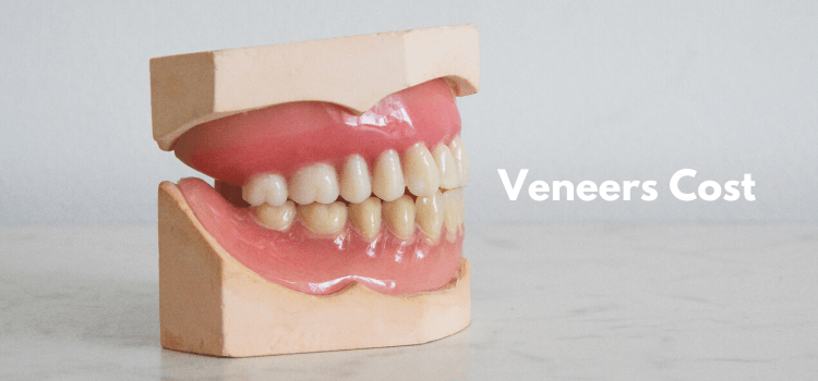 How much is a full set of veneers? - Dental News Network