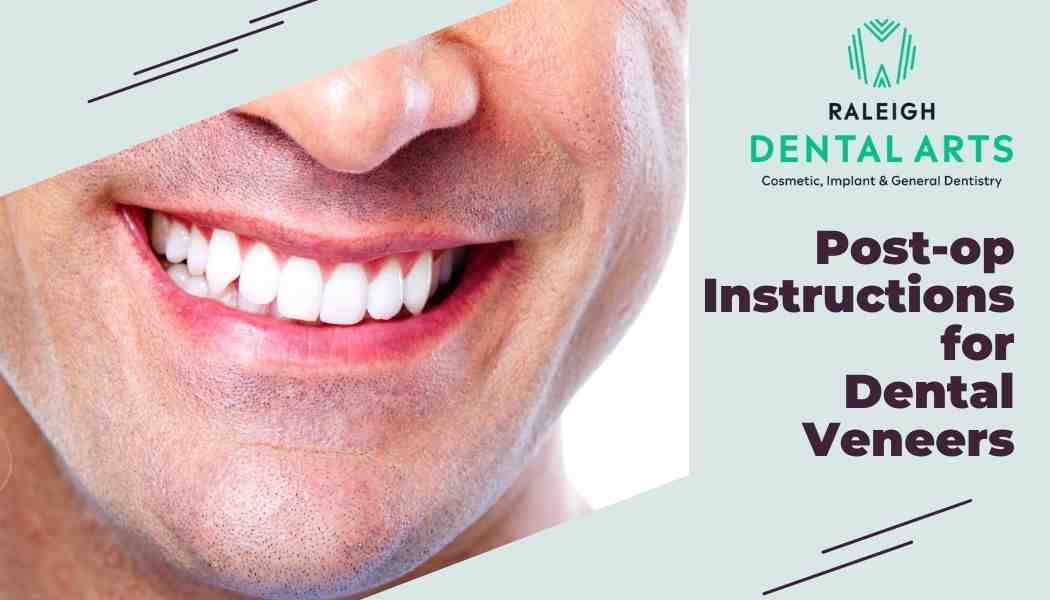 Do your teeth rot under veneers? - Dental News Network