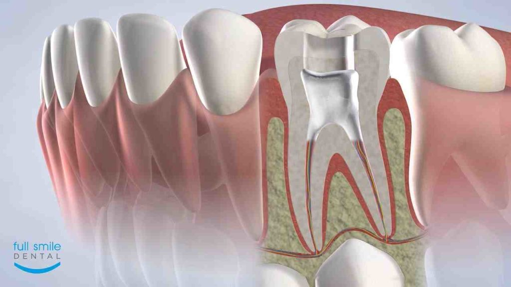 Do nerves grow back after root canal? - Dental News Network