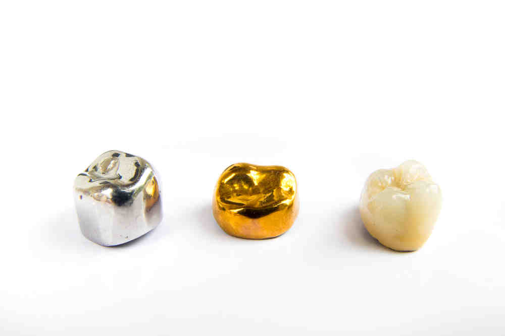 What Is The Difference Between A Cap And A Crown On Your Teeth What Is The Difference Between A Cap And A Crown On Your Teeth